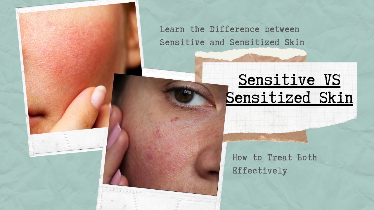 Sensitive Vs Sensitized Skin | Causes and Treatment - YouTube
