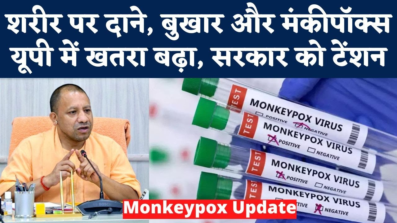 Monkeypox scare in India: मंकीपॉक्स की आहट से UP सरकार हुई सतर्क ...