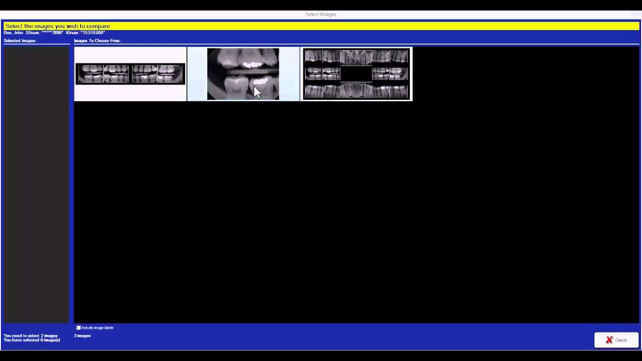 How to Compare X-rays Simultaneously | DentiMax Dental Imaging Software ...