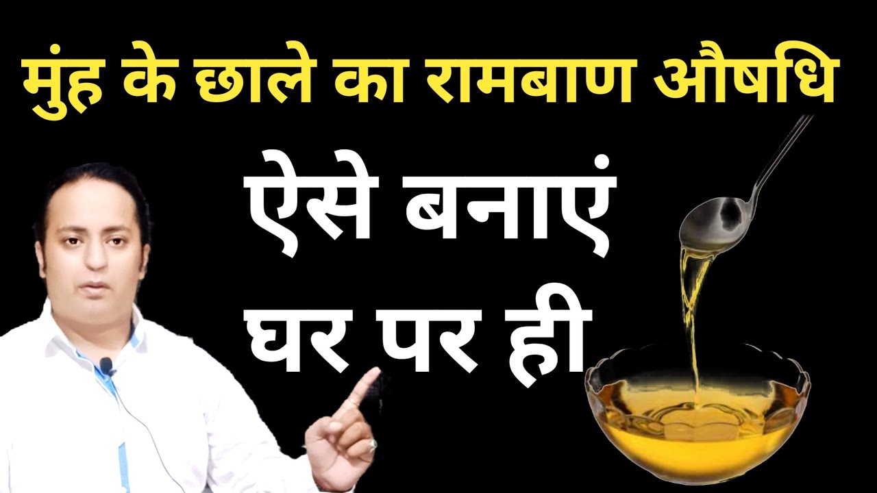 muh ke chale kaise thik kare। muh ke chale ke liye gharelu upaye - YouTube