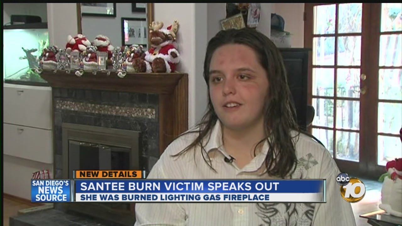 Santee woman burned while lighting family's gas fireplace speaks out ...
