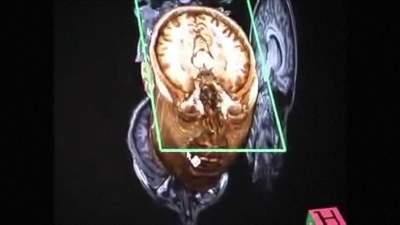 Ted Bundy, Video 4, July 3, 2017. - YouTube