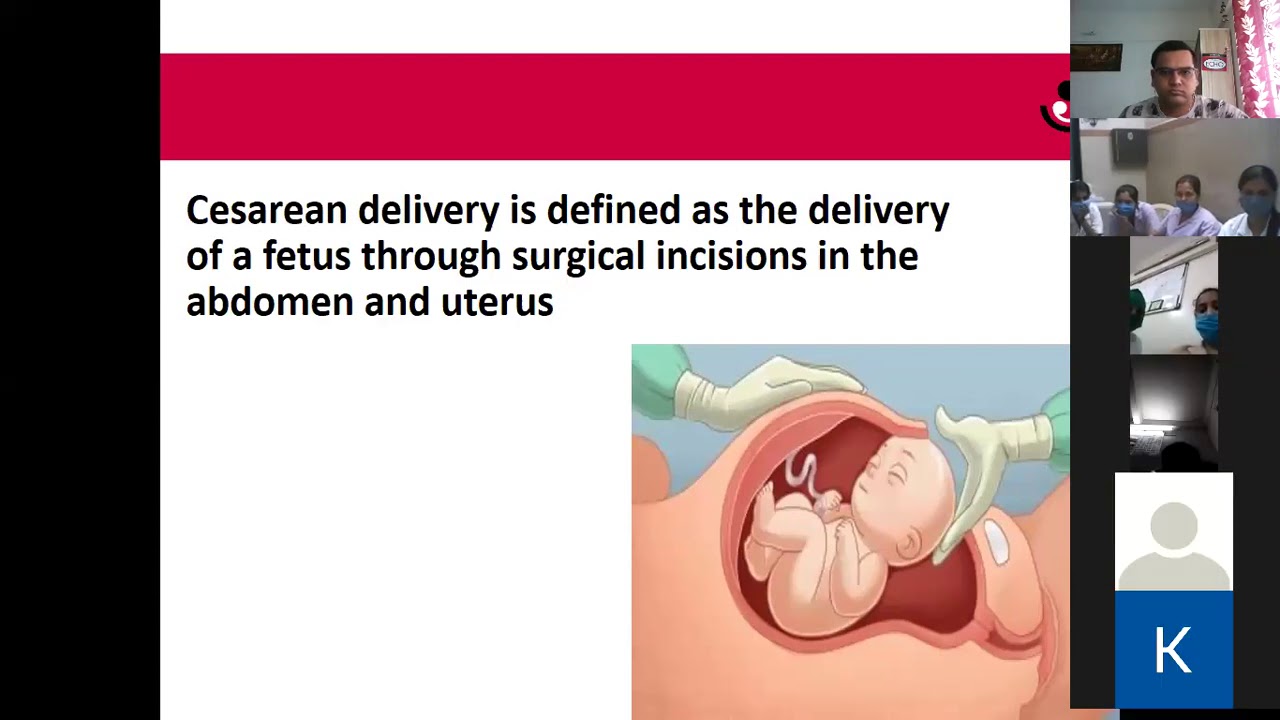 ECHO Session 18 Sept : On Clinical Standards 12 & 16 (NBR, LSCS ...