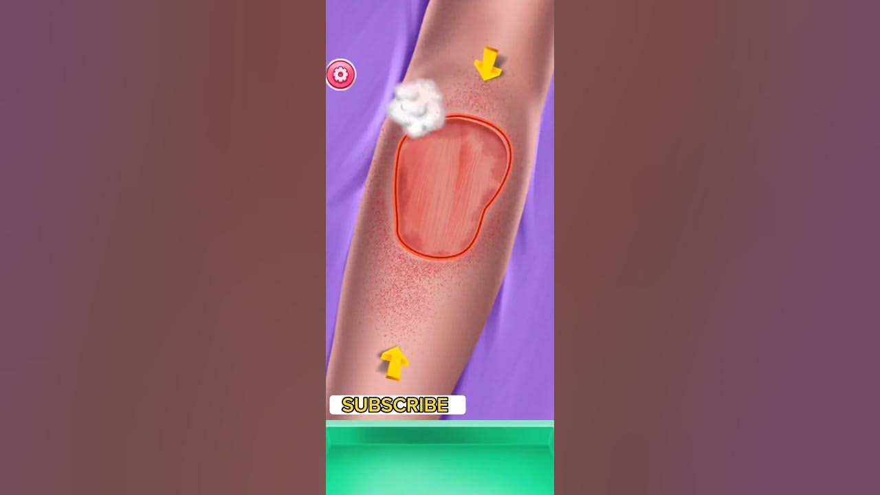 Surgery Animation C Section Shorts Diy Emotekill Viral Youtubeshorts Youtube
