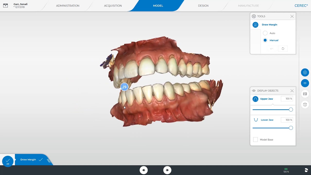 Export Stl Files From CEREC To 3D Print YouTube Export Stl Files From CEREC To 3D Print YouTube