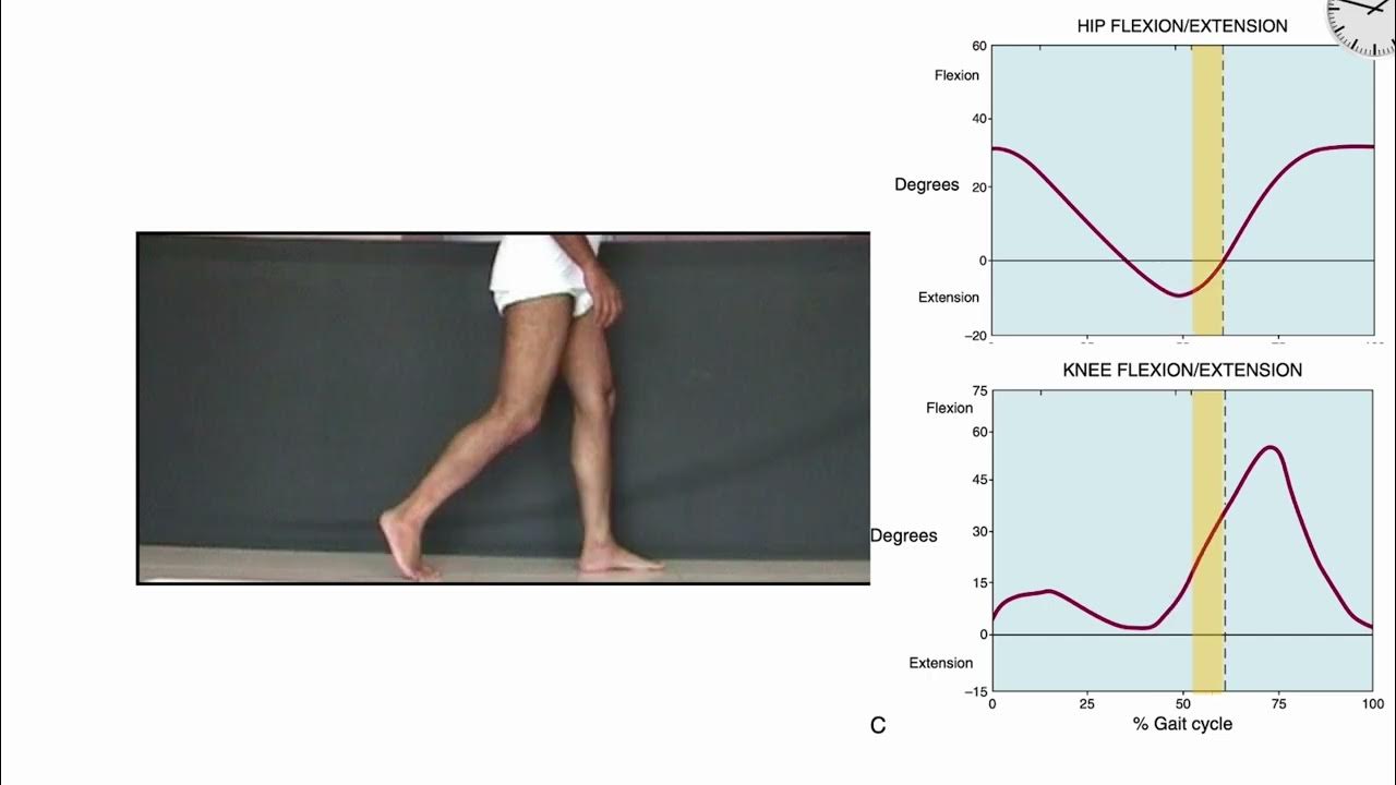 Understanding Gait analysis kinematic charts - YouTube