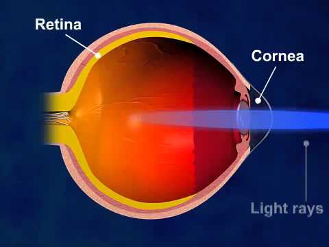 Lasik Surgery Procedure - Asian Eye Hospital Pune | Dr Vardhaman ...