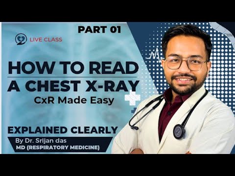 Part 1: Introduction to Chest X-Ray by Dr Srijan Das | Explained Clearly | CXR Made Easy ...