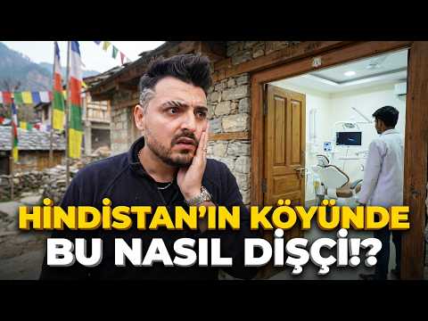 Acıdan AĞLADIM ! Hindistan'ın Köyünde Mecbur Dişçiye Gitmek Zorunda Kaldım Ama...