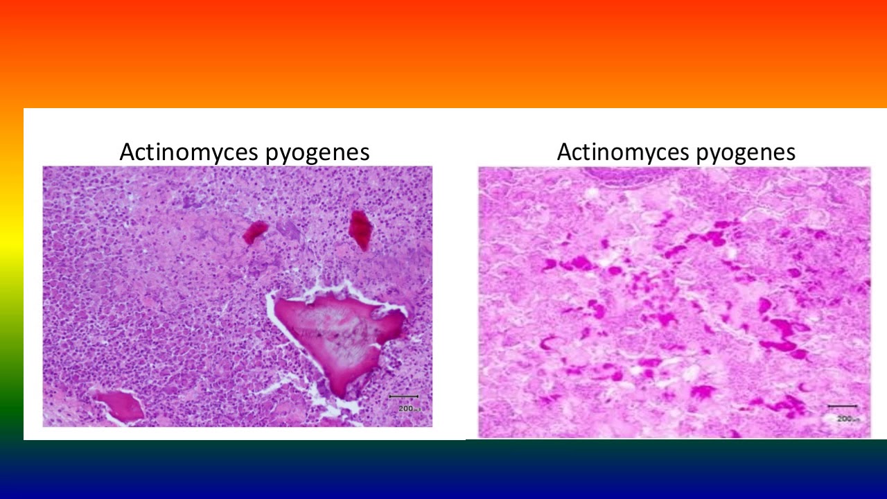 Actinomyces Pyogenes