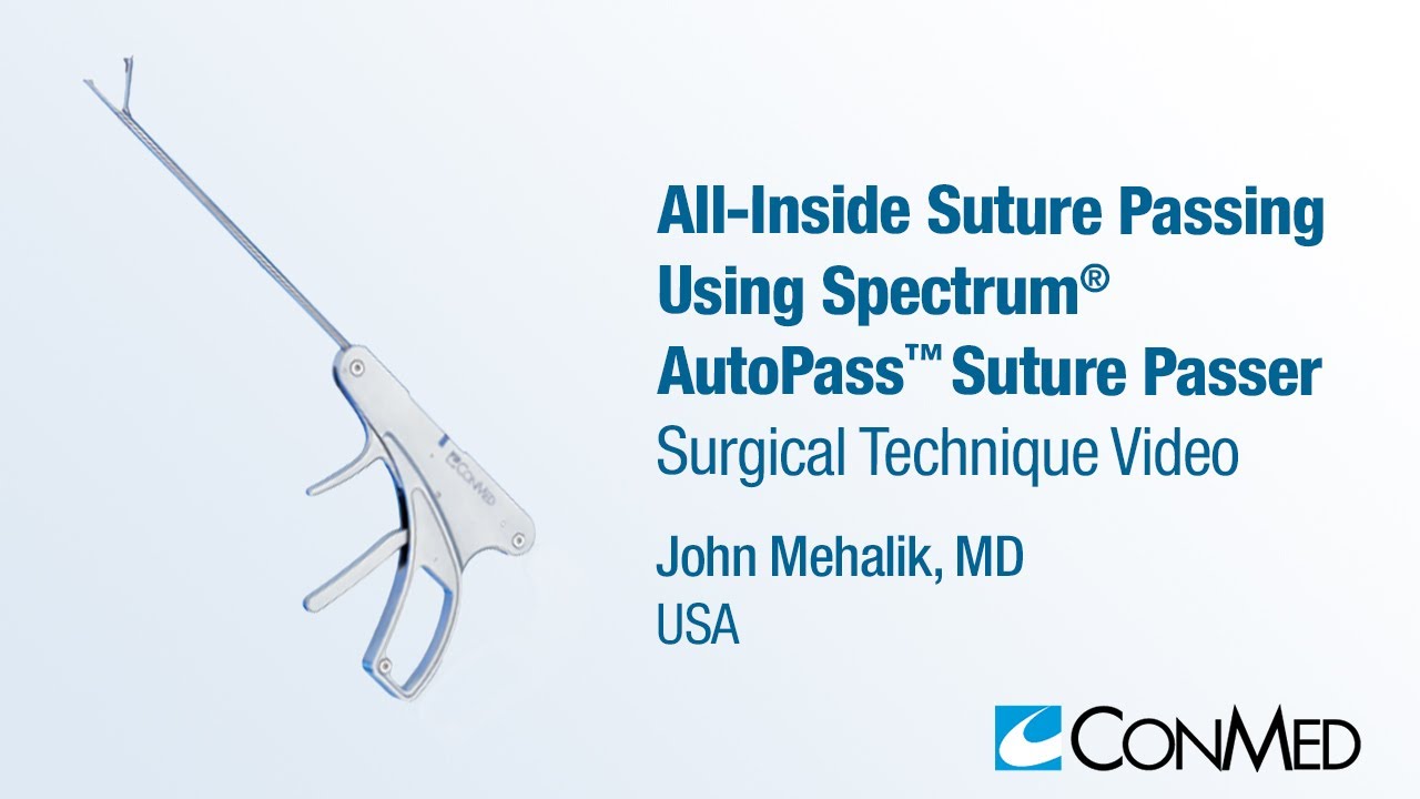 Dr. John Mehalik - All-Inside Suture Passing Using Spectrum® AutoPass ...