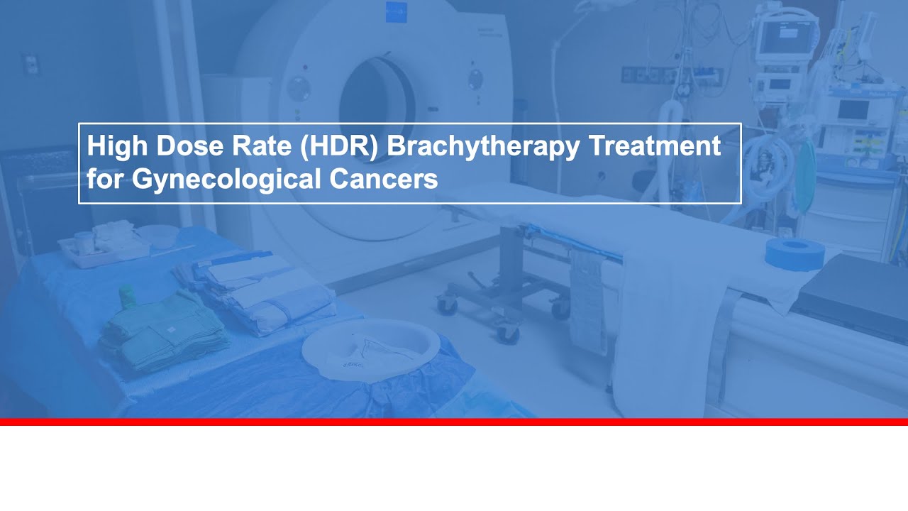 High dose rate (HDR) brachytherapy treatment for gynecological cancers ...