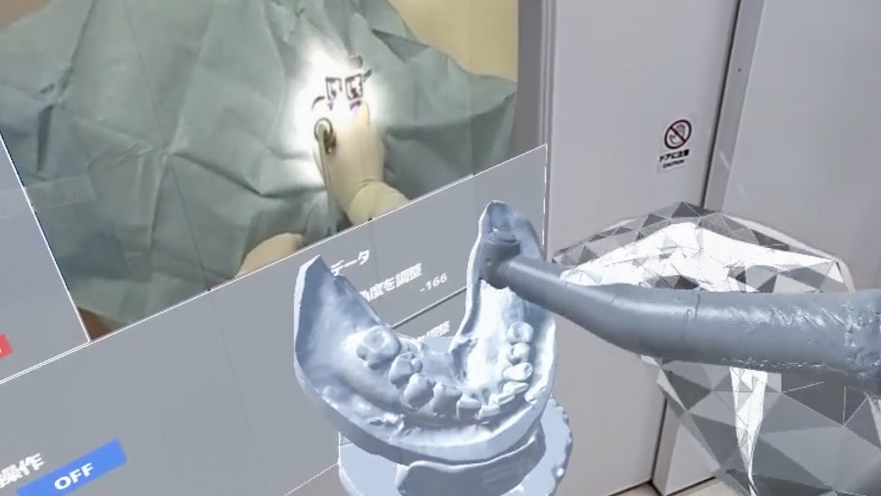 Video 3: Dental implant surgery using MR devices. Video seen by the ...