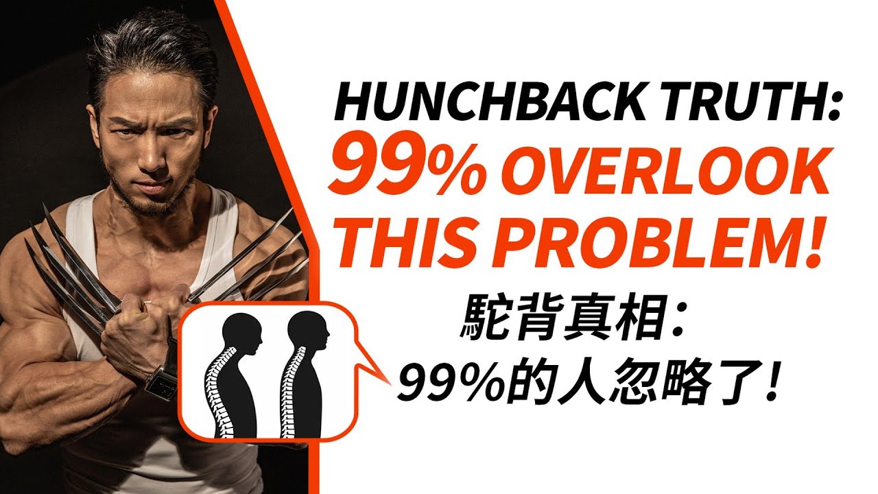Hunchback Truth: 99% Overlook This Problem! | 驼背真相：99% 的人忽略了！ - YouTube
