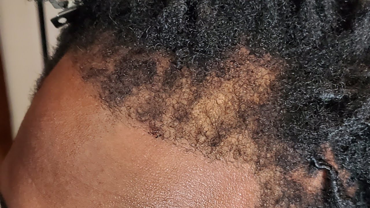 BROTHERS, STOP GETTING SHAPE-UPS. LET YOUR FULL HEAD OF LOCS GROW - YouTube