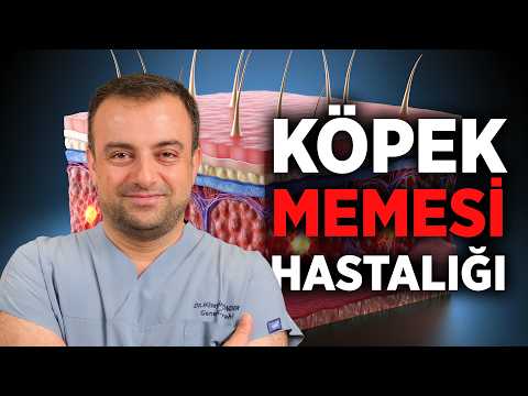 Köpek Memesi Hastalığı (Hidradenitis Suppurativa) Nedir? Evreleri ve Güncel Tedavi Yöntemleri