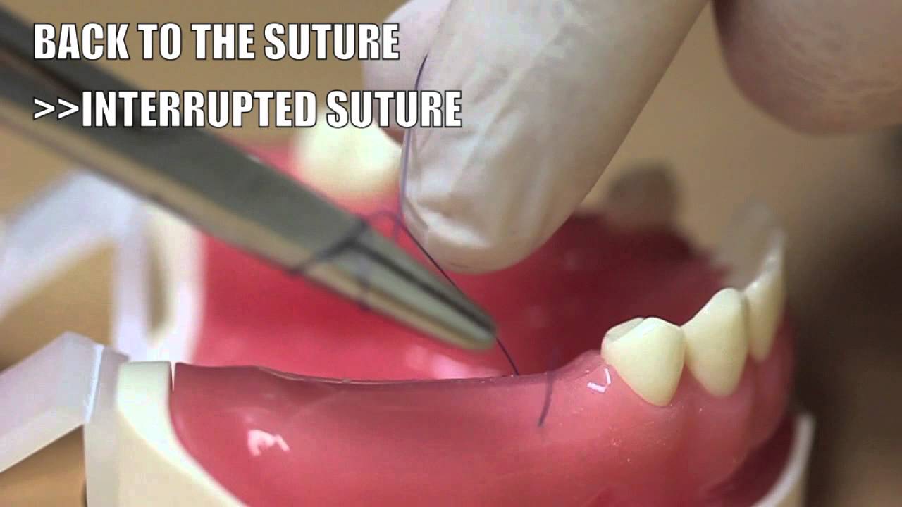 Back to the suture-1. Interrupted suture - YouTube