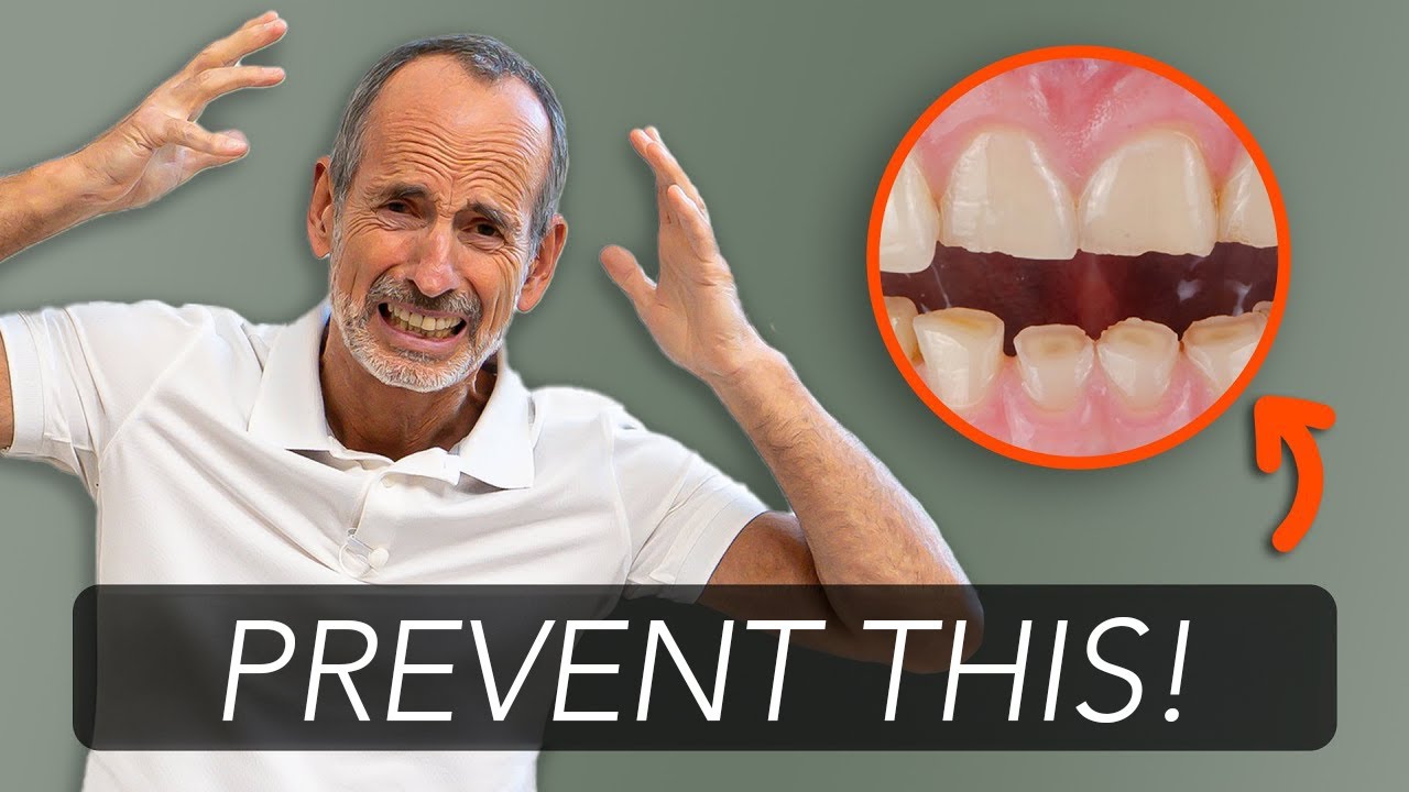 Exercises to stop teeth grinding during sleep jaw pain - YouTube