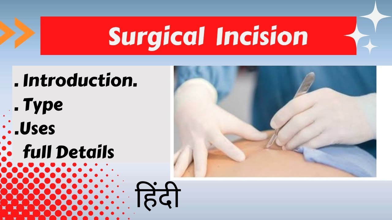 Surgical Incision || Full details in Hindi || Types of Surgical ...