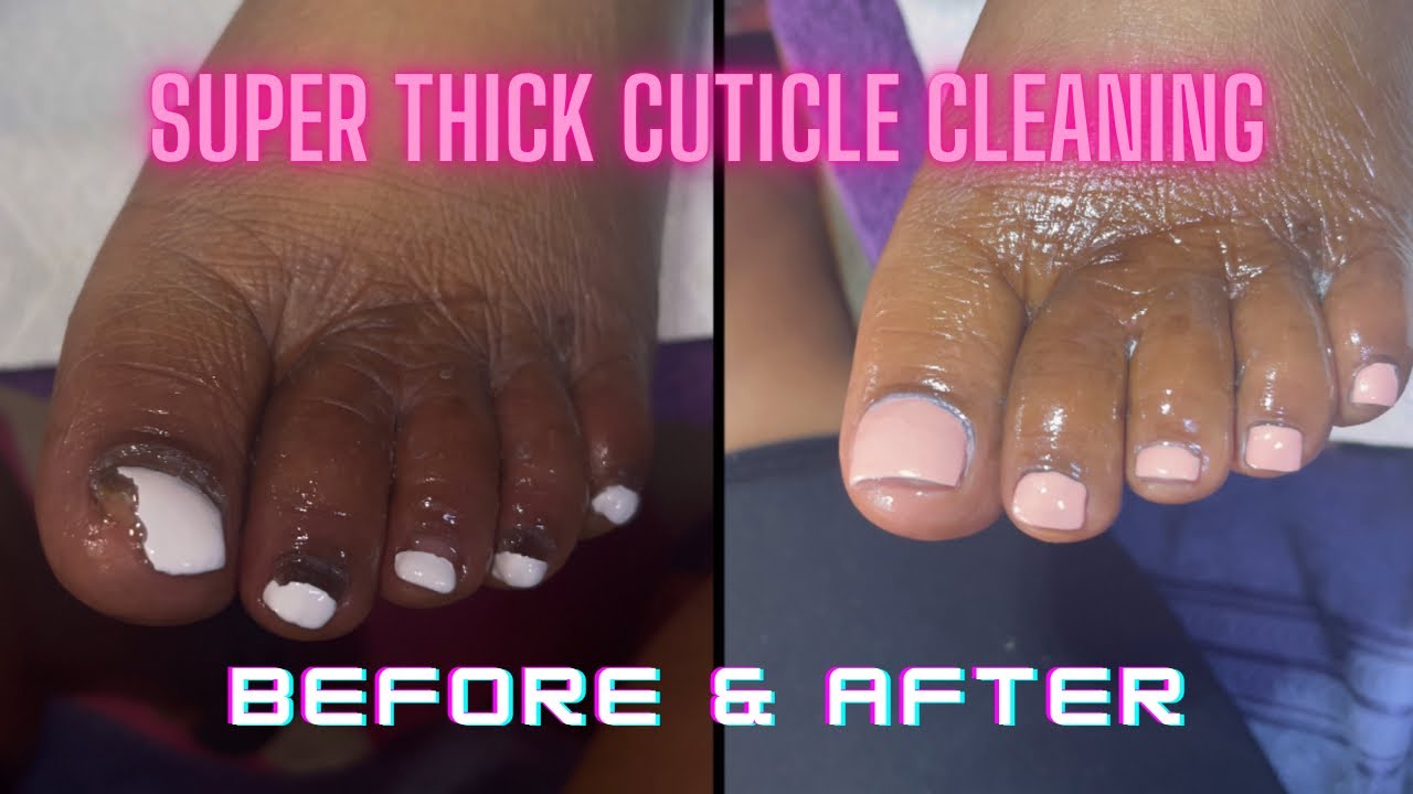 DETAILED SUPER THICK CUTICLE CLEANING‼️TOENAIL PREP WORK ️ - YouTube