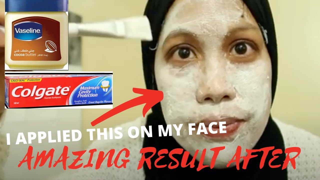 I Applied Toothpaste and Vaseline to my Face|| AMAZIING RESULT AFTER ...