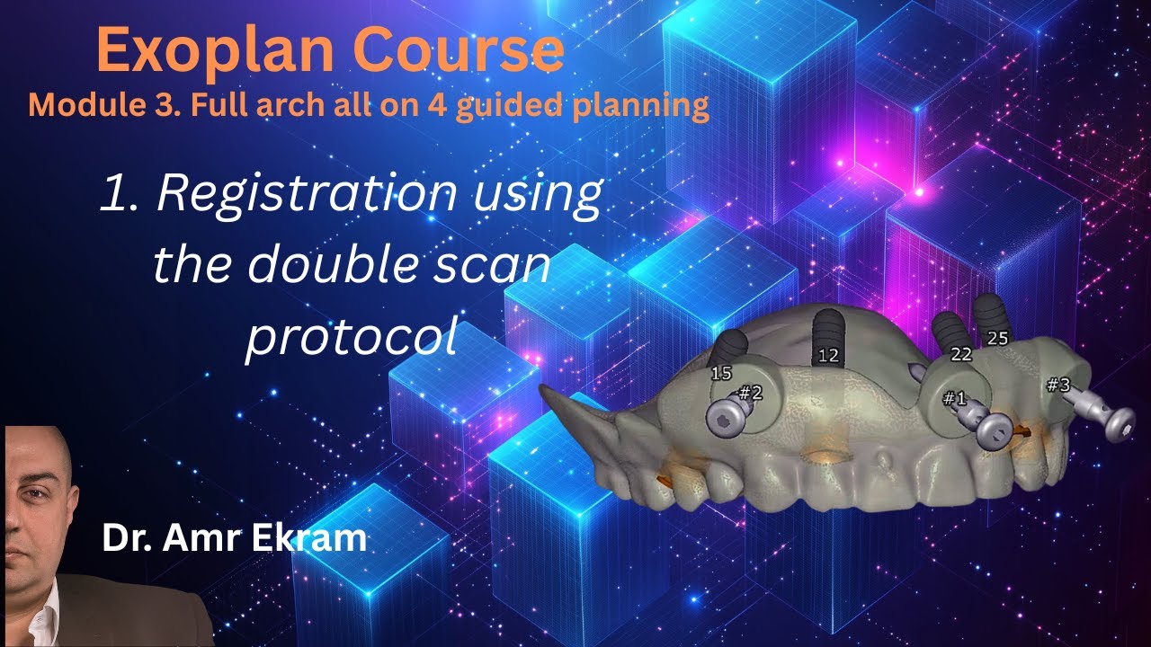 1 Registration using the double scan protocol in Exoplan (1/5) - YouTube