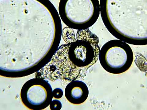 Fecal Float and intestinal parasites - YouTube