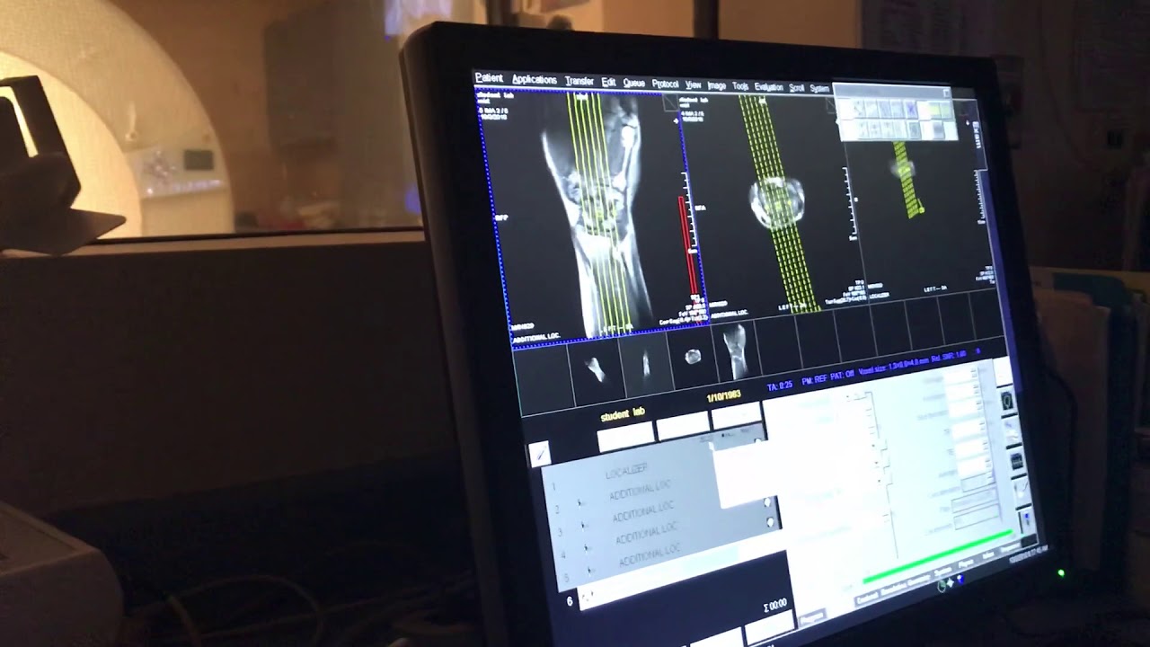 School of Medical Imaging MRI Lab Wrist - How to Localize - YouTube