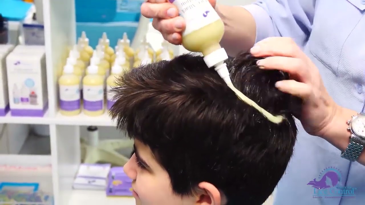 Apply Lice Attack Solution to Short Hair - YouTube