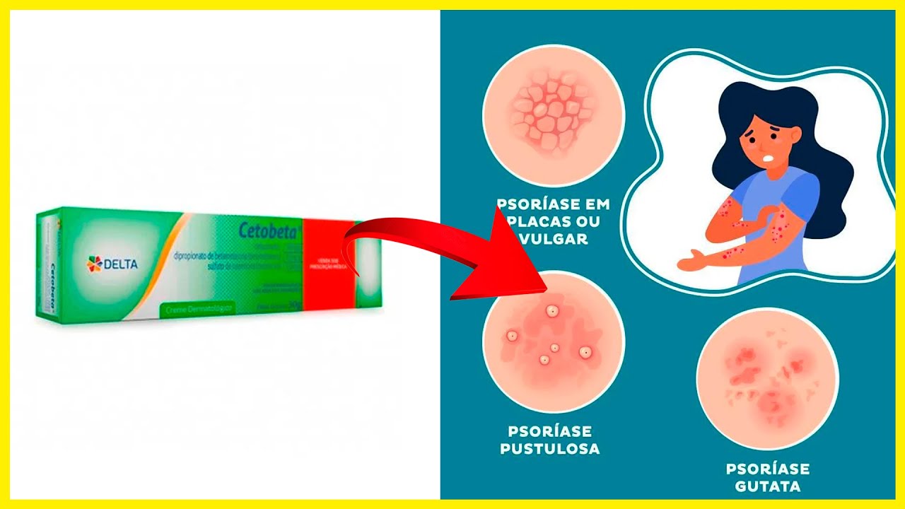 CETOBETA - Serve para Quê? - YouTube