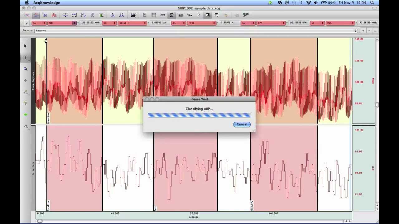 Focus Areas | AcqKnowledge Tutorial - YouTube