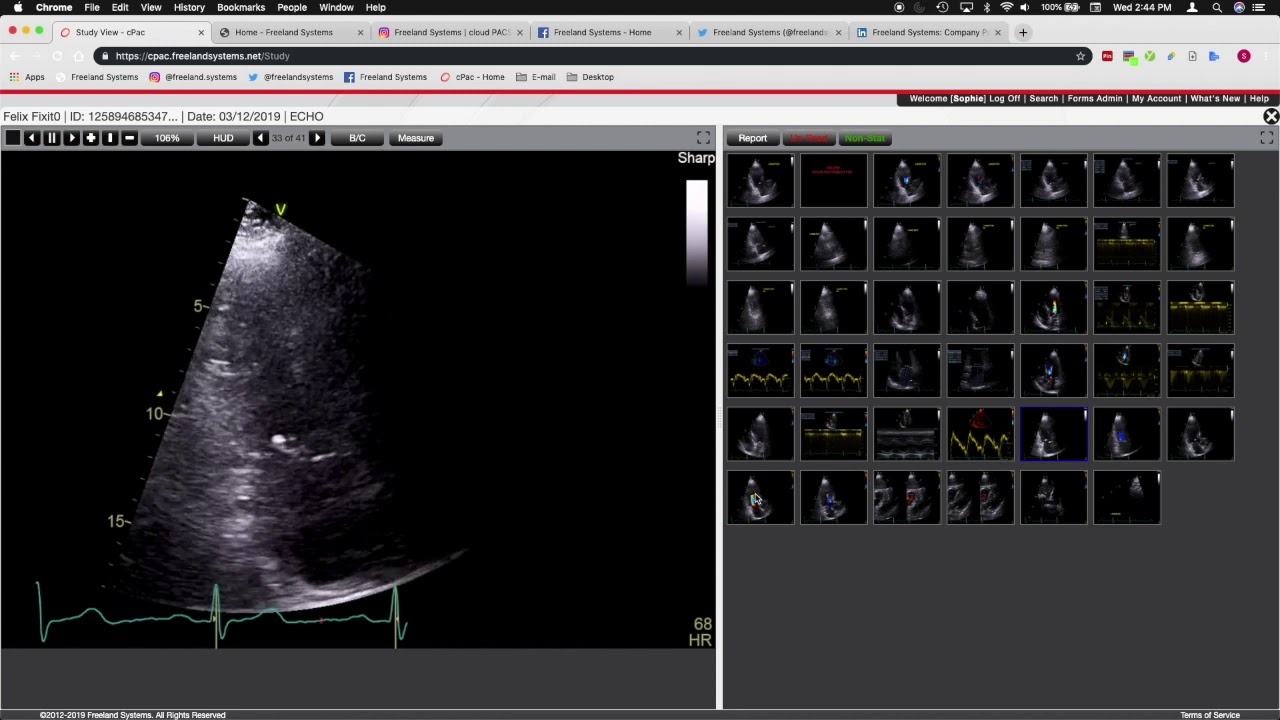 cPAC | Cloud-Based PACS by Freeland Systems - YouTube