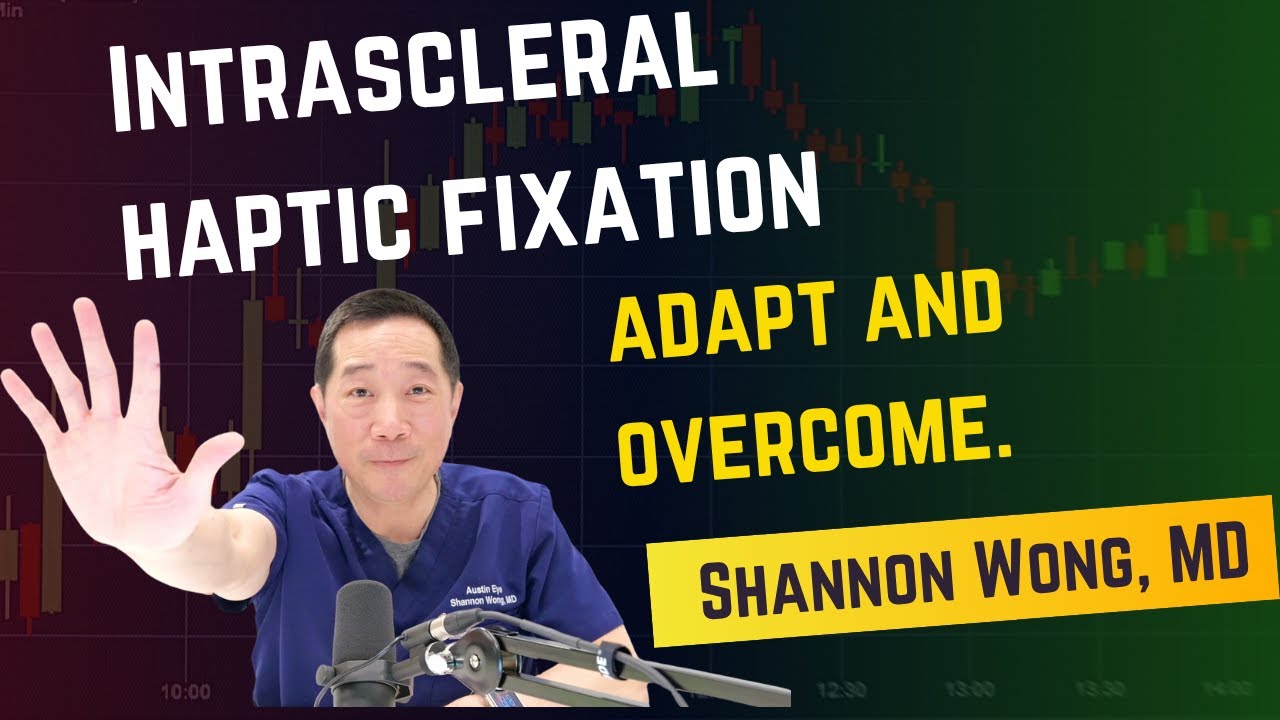 Intraocular lens exchange: A Trilogy. Ep 3 of 3: Intrascleral haptic ...