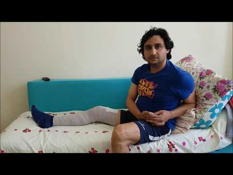 ÖN ÇAPRAZ BAĞ AMELİYATI SONRASI EVDEYİM.(AFTER ACL SURGERY)