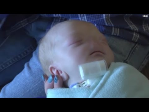 Pic of baby with no nose too shocking for FB ad? - YouTube