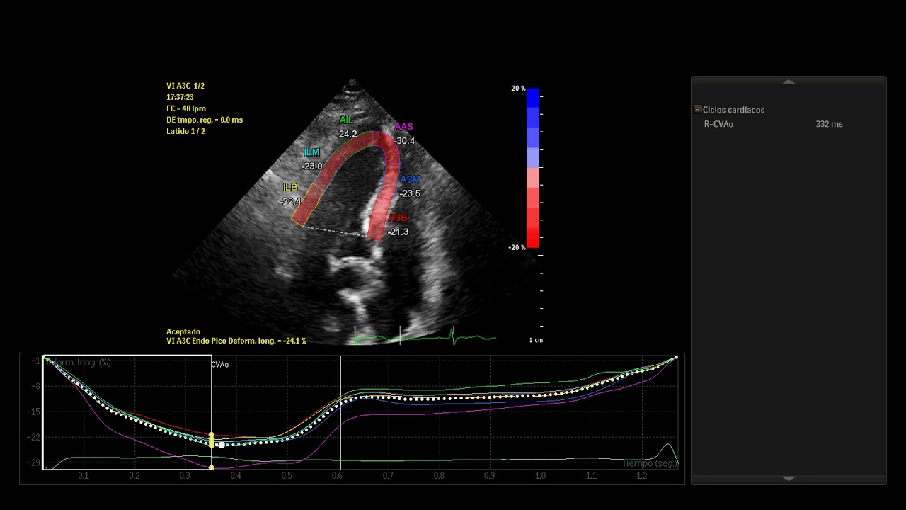 Philips qlab acmq quick guide - woogast