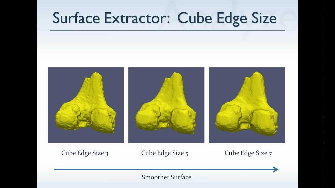 Bone Segmentation and Surface Generation with Analyze 10.0 - Webinar ...