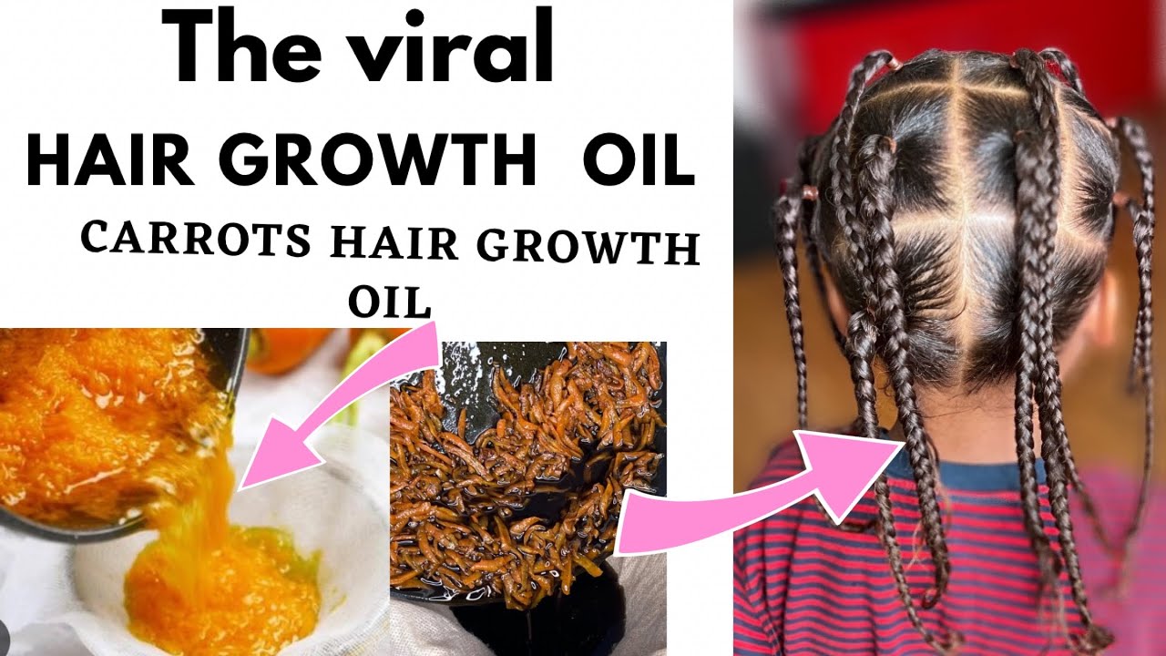 The Viral Hair Growth Oil That Will Change Your Life.This Oil Brought ...