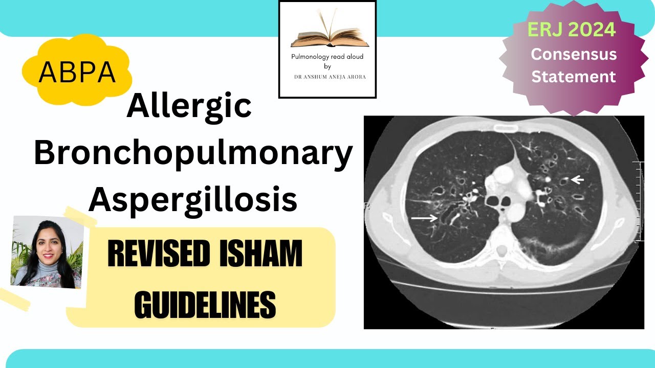 ABPA guidelines 2024: Revised ISHAM consensus - YouTube