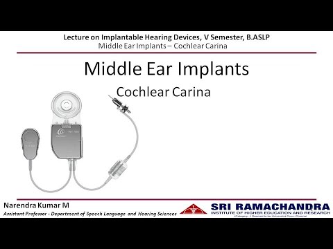 Middle Ear Implants - Carina - YouTube