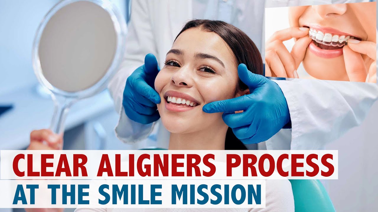 Clear aligners process at The Smile Mission - YouTube