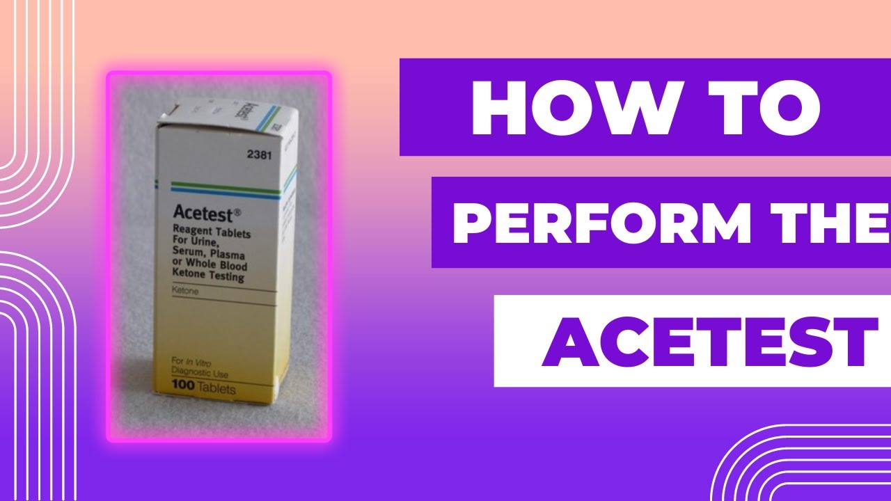 How to Perform an Acetest - YouTube