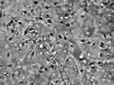 Semen at 400 magnification under the microscope from around (2010-2012 ...