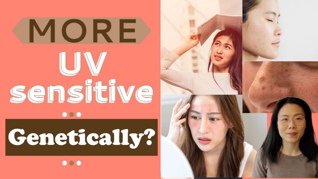 Genetically MORE sensitivity to UV: syndromes, diagnosis, and support ...