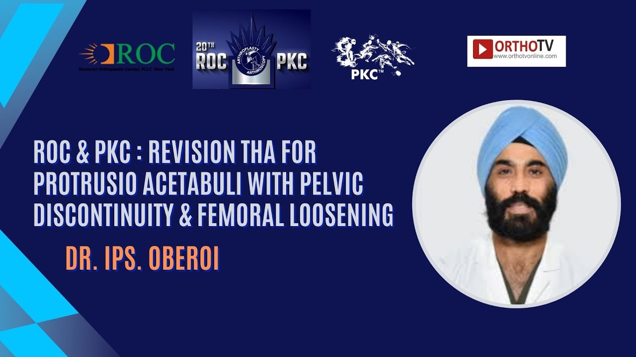 ROC & PKC: THA Revision for Protrusio Acetabuli & Pelvic Discontinuity ...