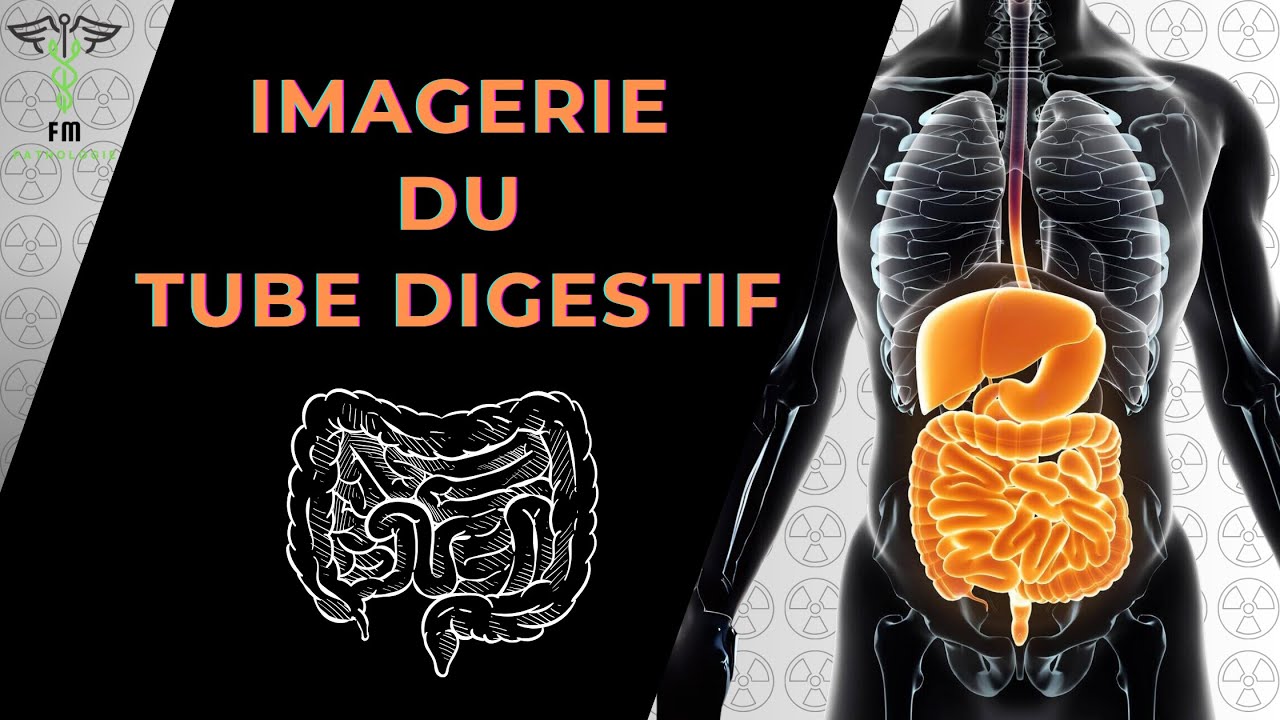 Imagerie Du Tube Digestif - YouTube