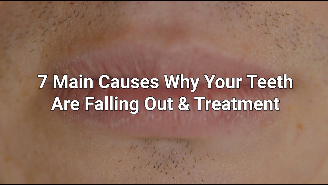 7 SHOCKING Reasons Your Teeth Are Falling Out (+ Prevention Tips!) 🦷 ...
