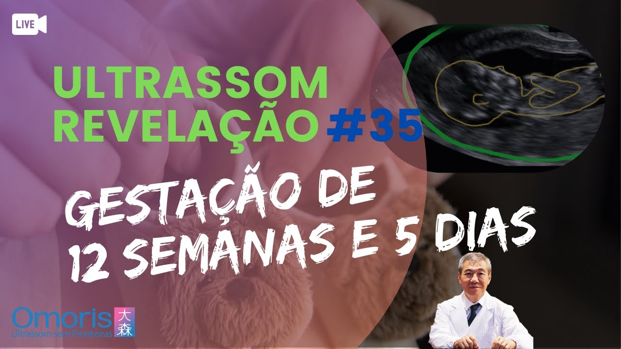 Gravidez 12 semanas - Desafio revelação do sexo do bebê #35 - YouTube