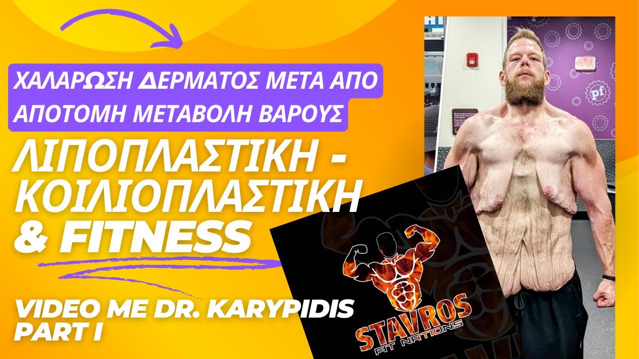 Χαλαρωση δερματος απο εντονη απωλεια βαρους & αισθητικη επεμβαση - Dr ...