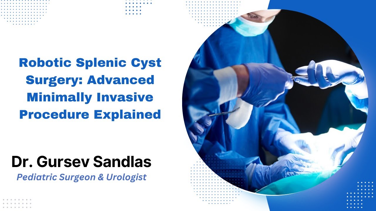 Robotic Splenic Cyst Surgery: Advanced Minimally Invasive Procedure ...